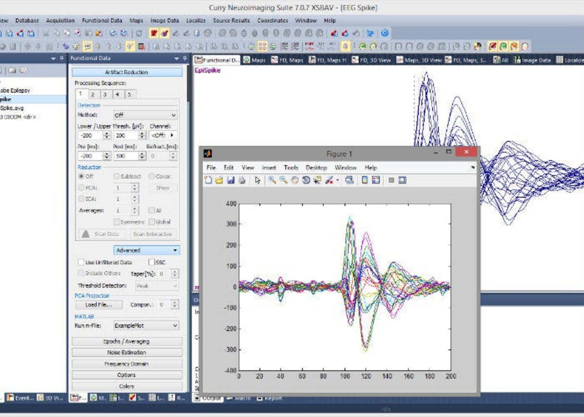 Las 5 mejores alternativas a Matlab para Linux